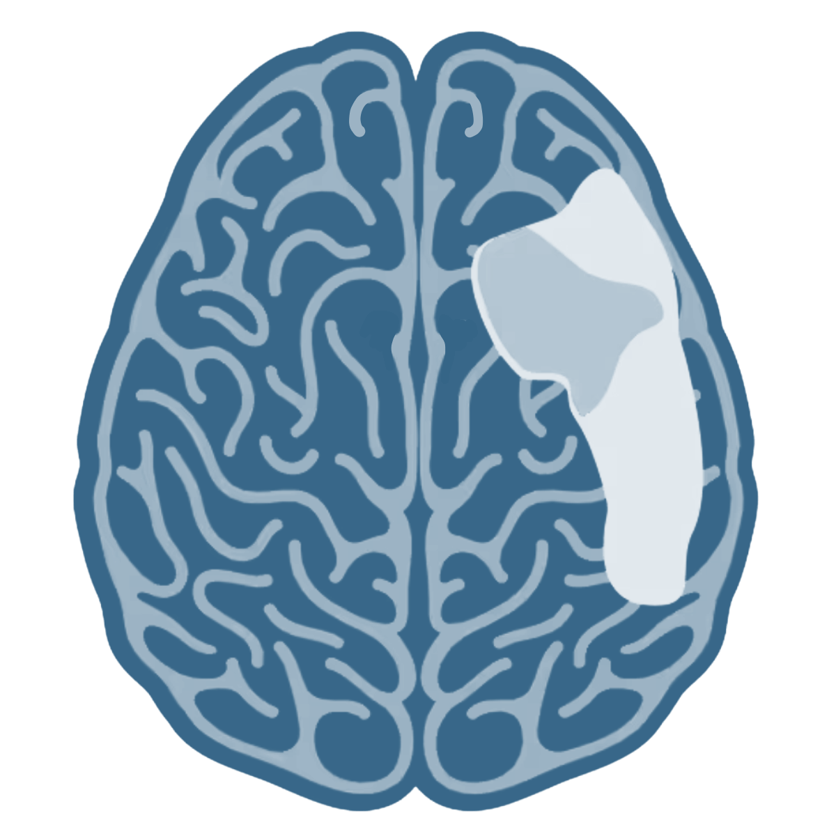 Stroke Risk Assessment - CaptureCare